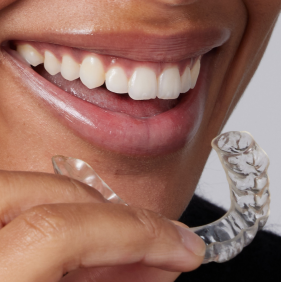 SmileGuard Request Info